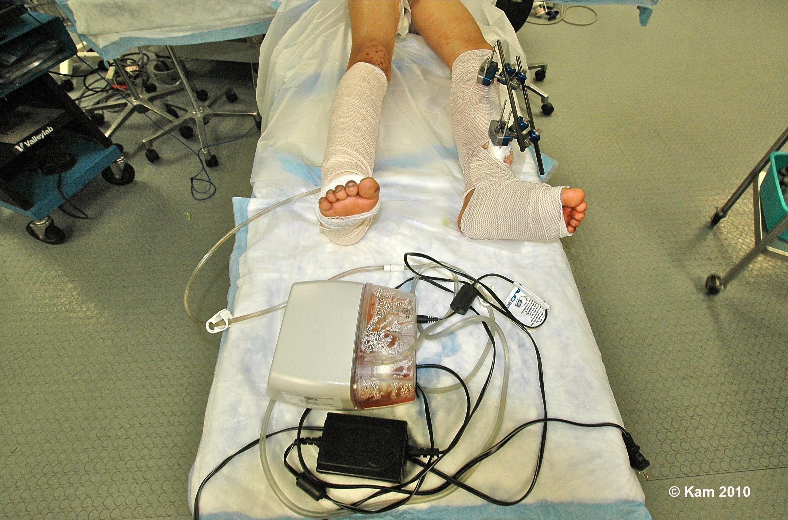 I. Combat/Disaster Injuries : Wheeless' Textbook of Orthopaedics